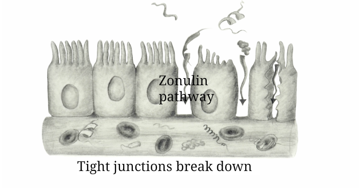 zonulin pathway – Hashimotos Healing